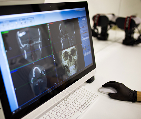 X-Ray Film Digitizing Services - AMS Store and Shred